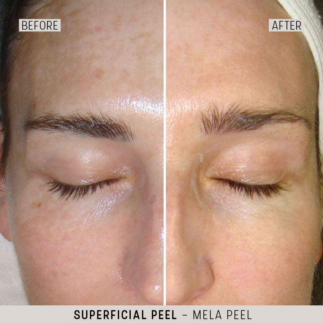 Dermaceutic Skincare: Innovative Dermaceuticals - Brains Street